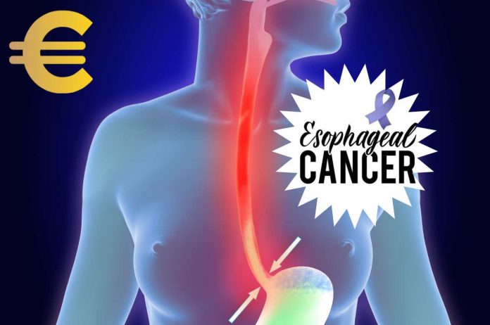 Cancro all'esofago: attenzione a questo sintomo, potrebbe salvarci la vita